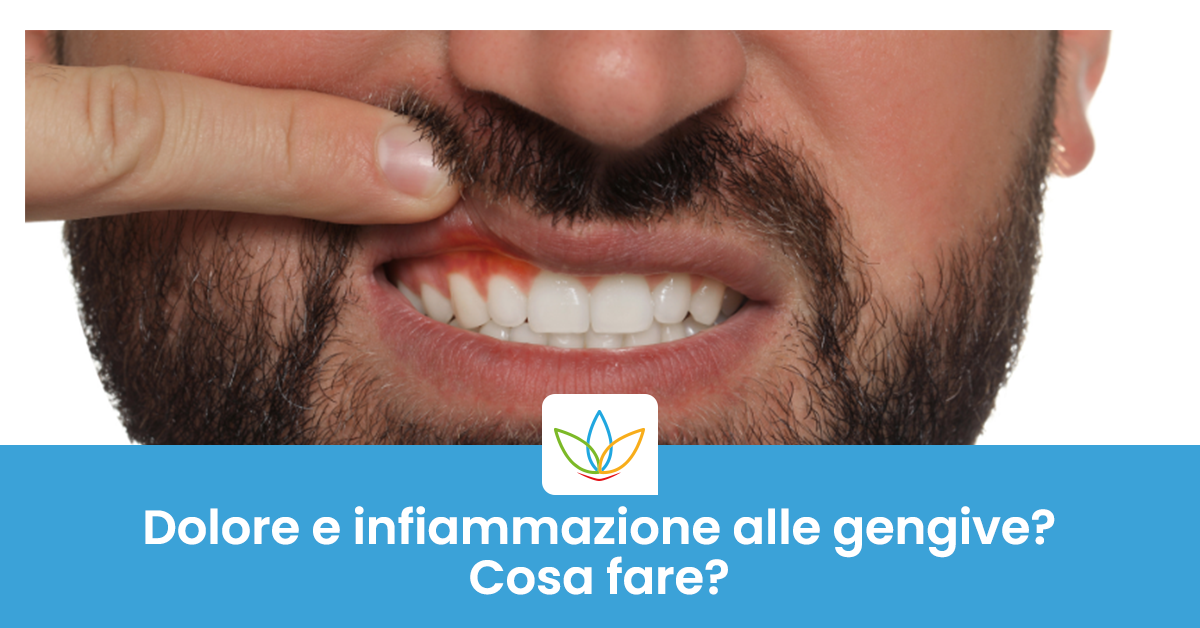 Gengive infiammate e doloranti: cause, rimedi e prevenzione. - SaluteIN ... Gengive infiammate e doloranti: cause, rimedi e prevenzione. - SaluteIN ...